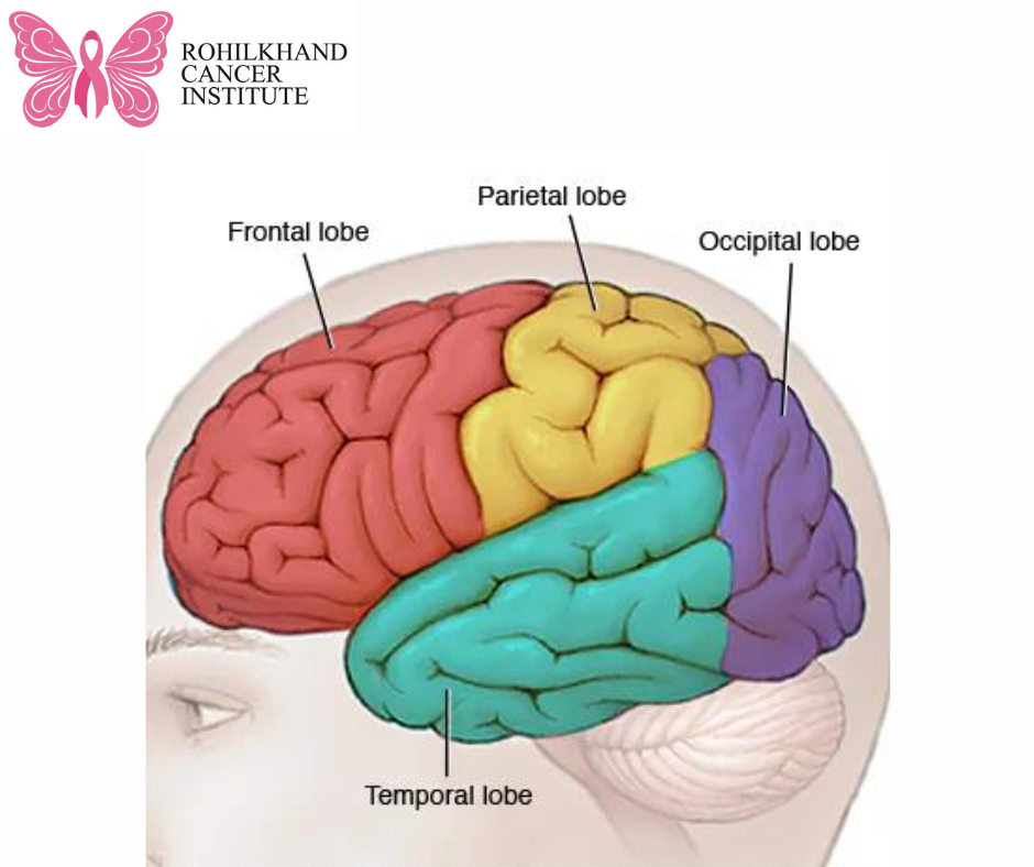 Brain tumor – Symptoms and causes - Rohilkhand Cancer Institute | Pet ...